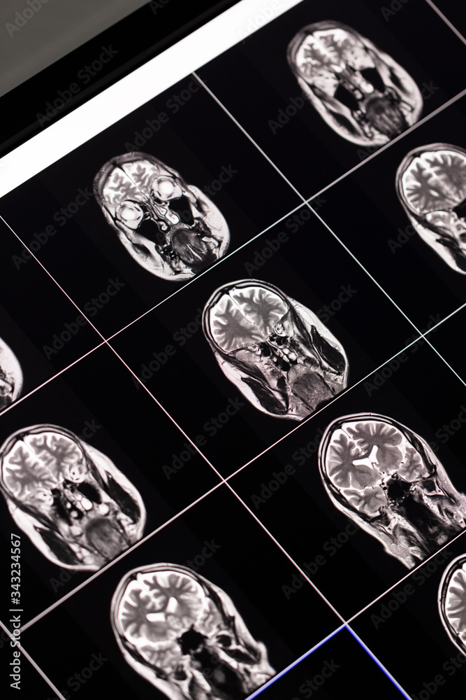 MRT images of a human head Stock Photo | Adobe Stock
