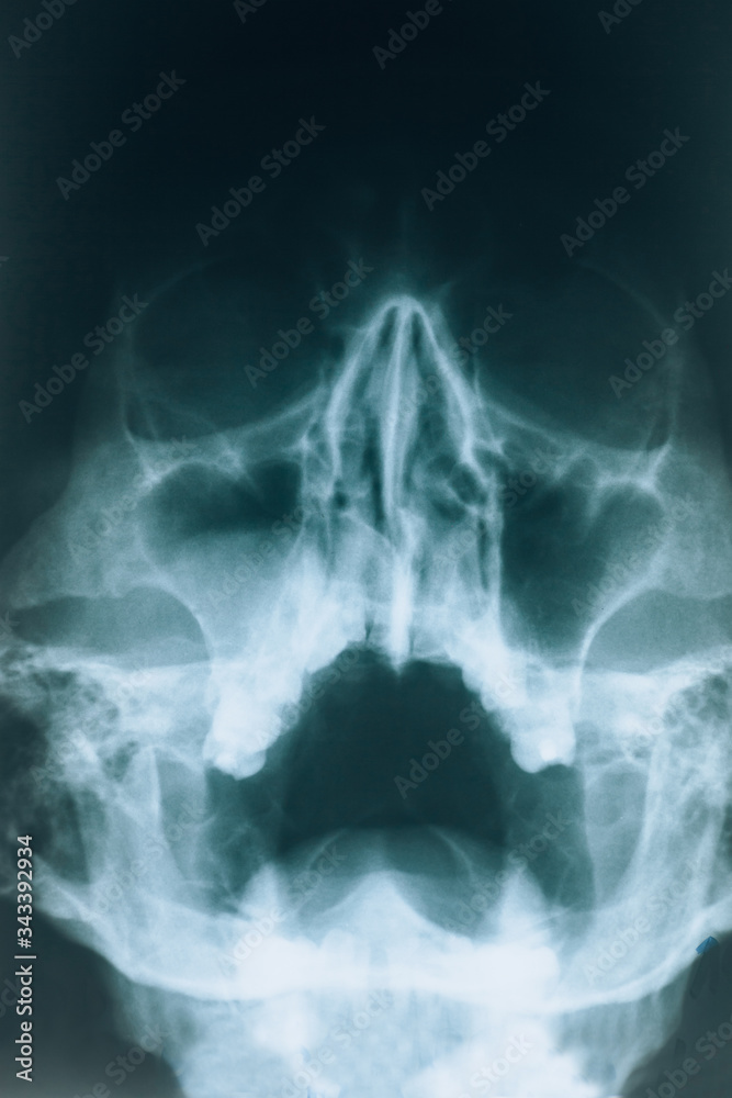 X-ray of the head. Real x-ray picture of a human skull at a doctor’s ...