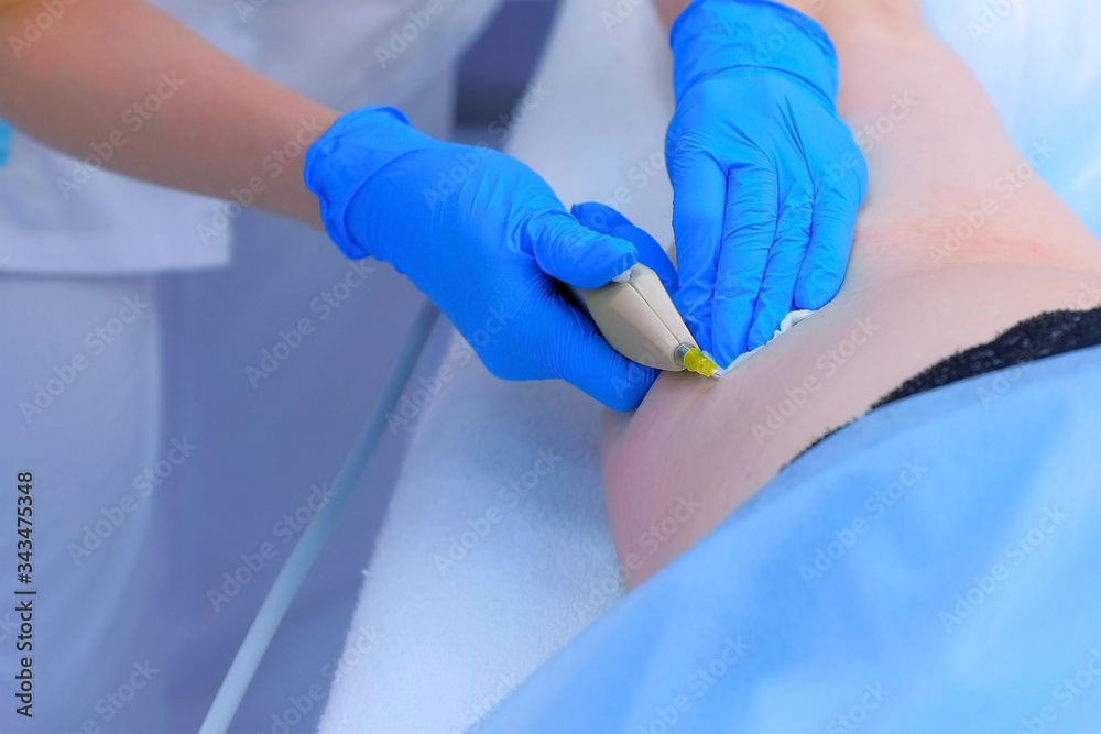 Doctor is making injection of carbon dioxide on patient's leg on ...