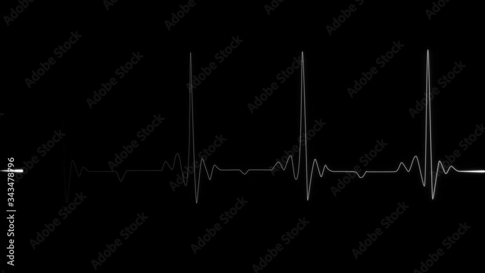 Pulse Line Heartbeat. Cardiac Arrest. Realistic Animated Heart Rhythm ...