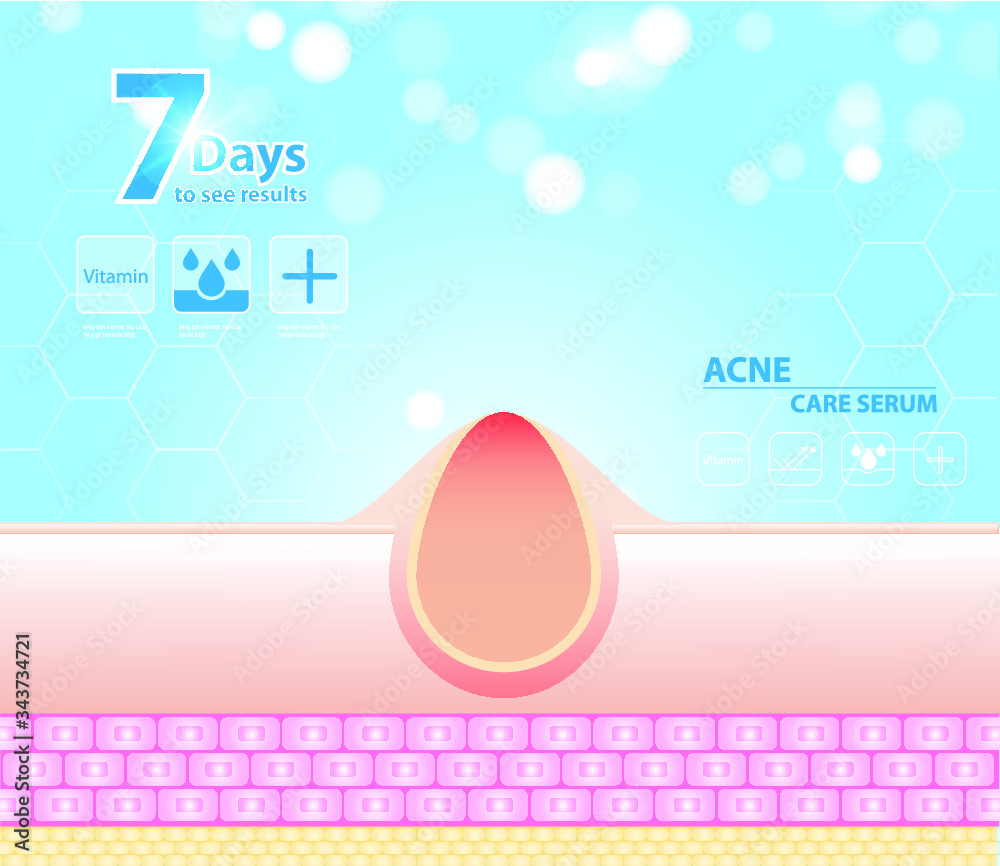 Three main layer of the human skin. skin aging stages diagrams, ollagen ...