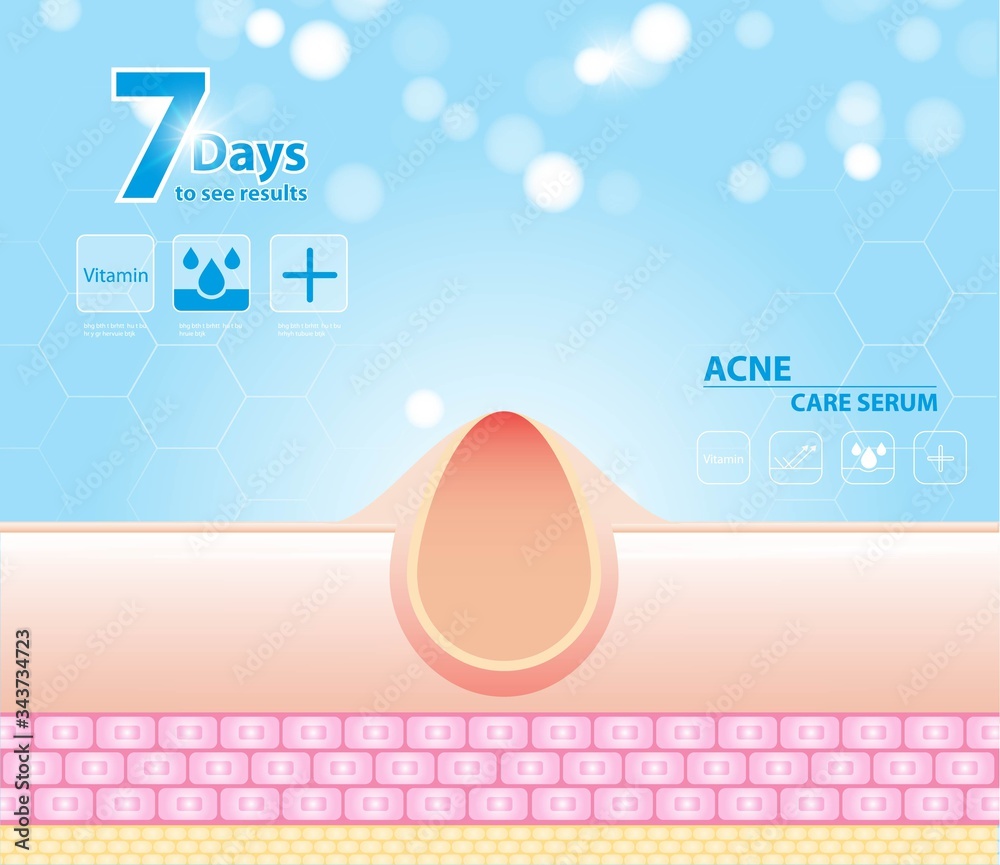 Three main layer of the human skin. skin aging stages diagrams, ollagen ...