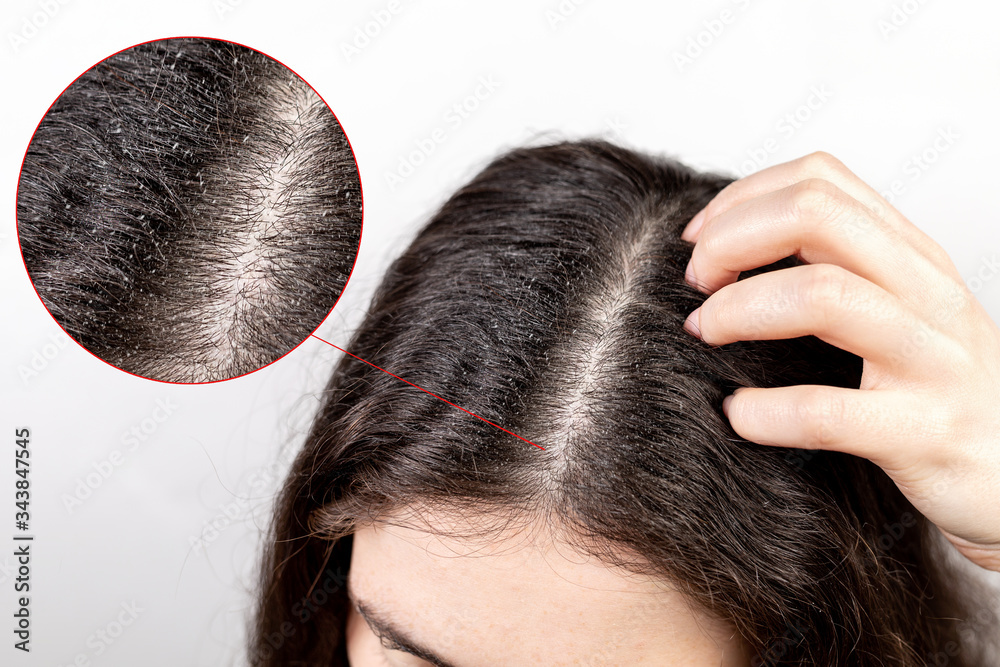 The Woman Scratches Her Head With Her Hand Showing A Parting Of Dark