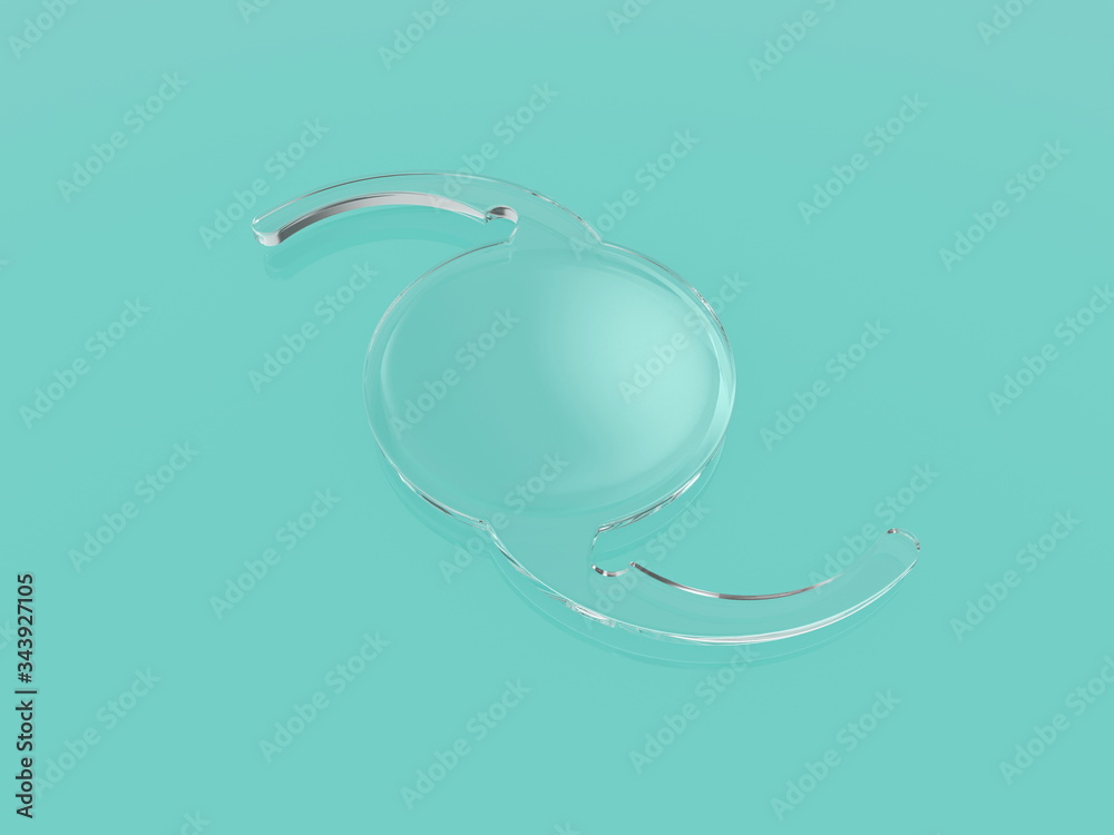iol intraocular lens cataract ophthalmology Stock Photo | Adobe Stock