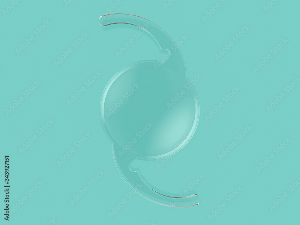 iol intraocular lens cataract ophthalmology Stock Photo | Adobe Stock