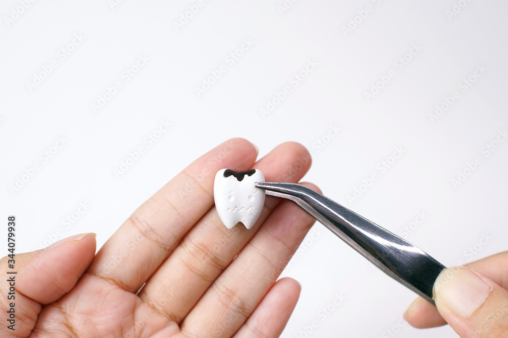 Decayed tooth pinching by clamp on hand on white background, Signs of ...
