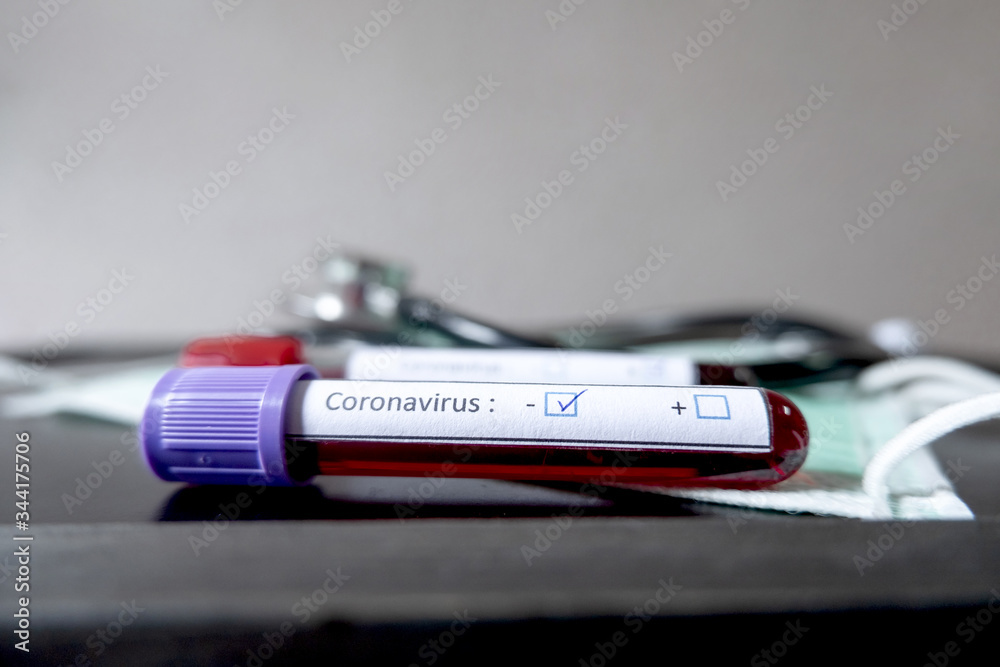 Professional doctors perform COVID-19 tests from samples of blood tests ...