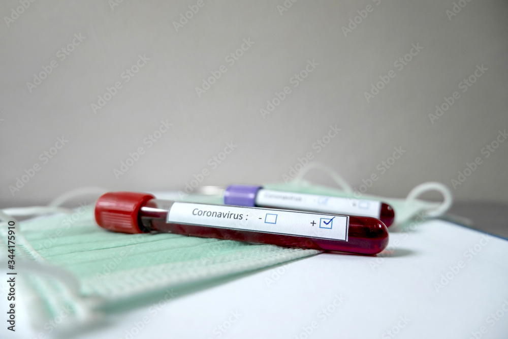 Professional doctors perform COVID-19 tests from samples of blood tests ...