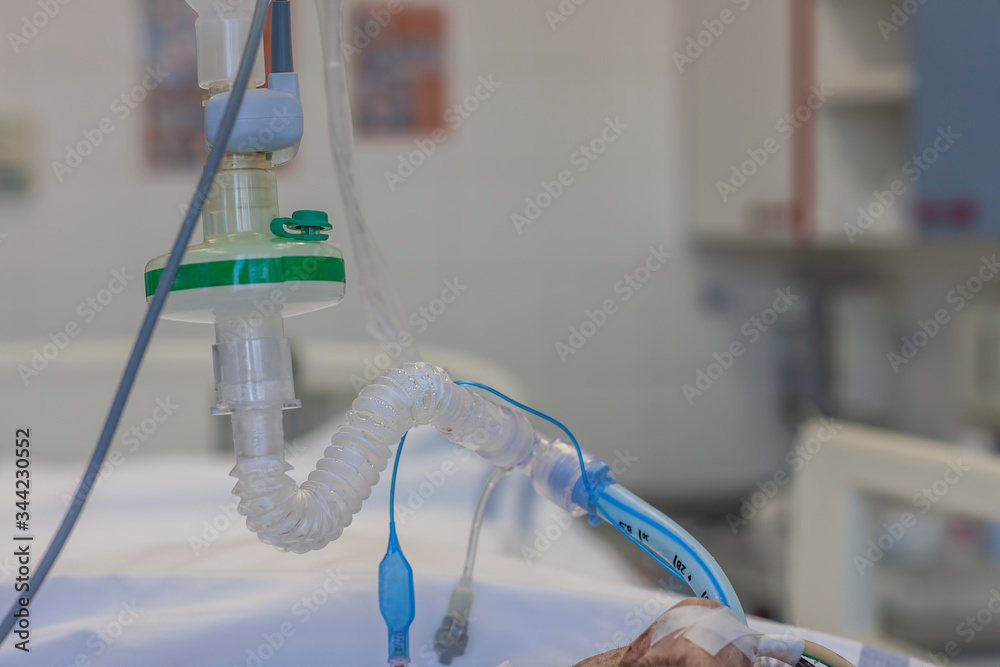 Endotracheal tube, HME filter, carbon dioxide sensor, patient connected ...