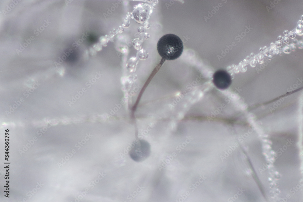 Black Bread Mold Under Microscope