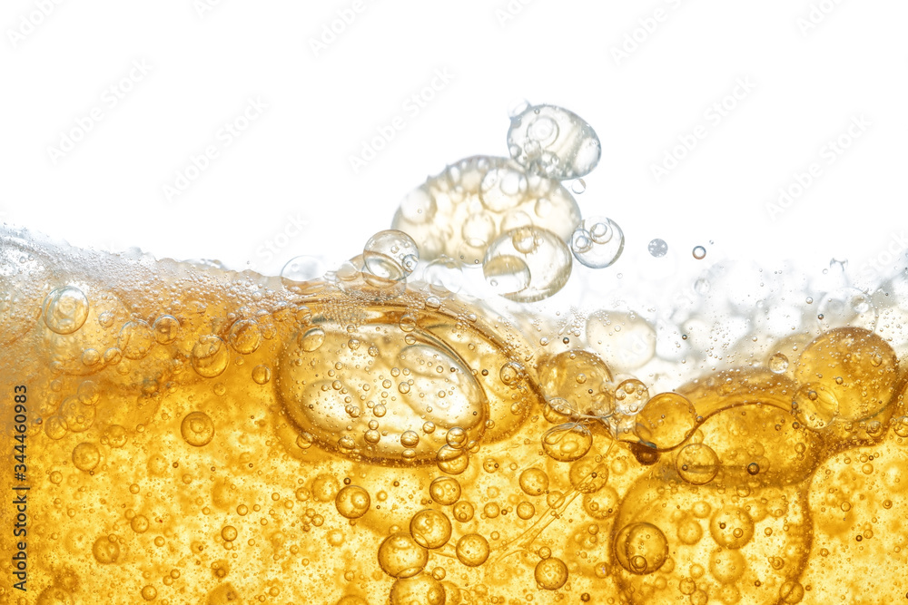 Conceptual image, yellow fat, like obesity cells, under the microscope ...