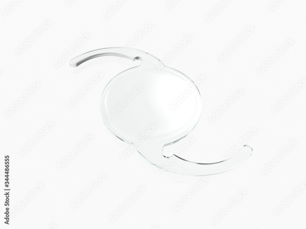 iol intraocular lens cataract eye Stock Photo | Adobe Stock