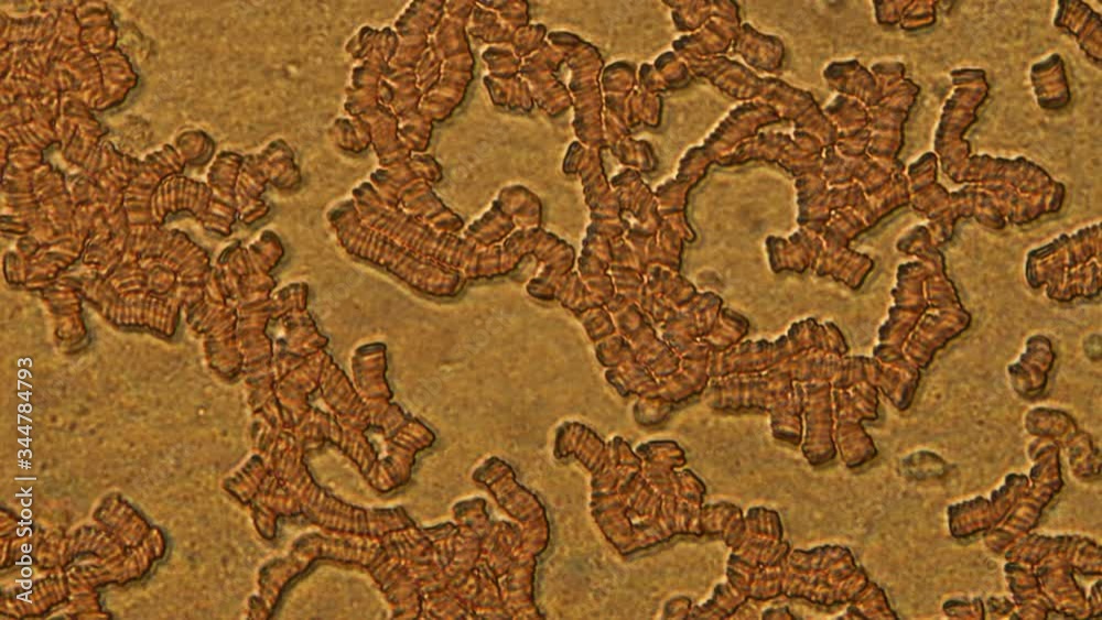 Microscopy of human blood cell test. Magnification 150x moving of red ...