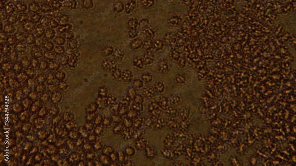 Microscopy of human blood cell test. Magnification 600x moving of red ...