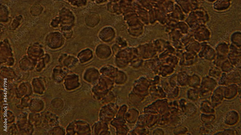Microscopy of human blood cell test. Magnification 600x moving of red ...