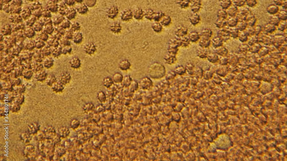 Microscopy of human blood cell test. Magnification 300x moving of red ...