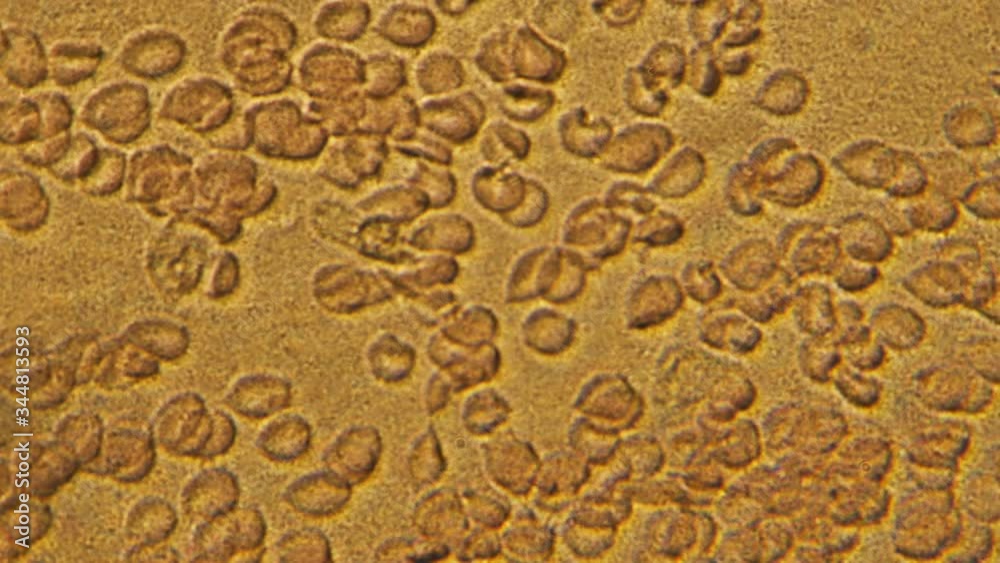 Microscopy of human blood cell test. Magnification 600x moving of red ...