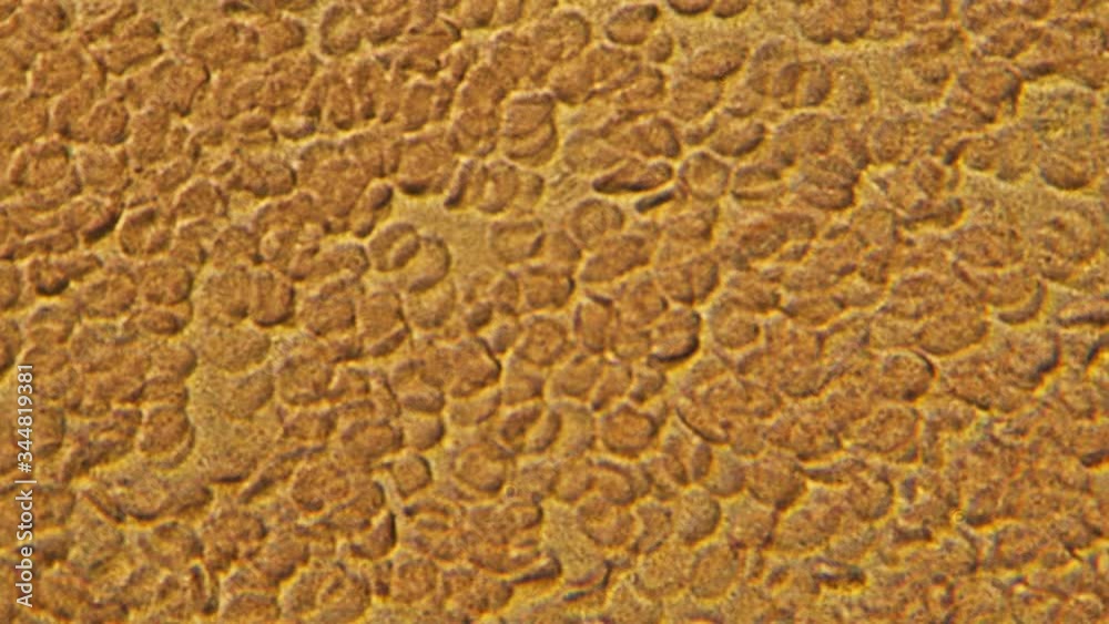 Microscopy of human blood cell test. Magnification 600x moving of red ...