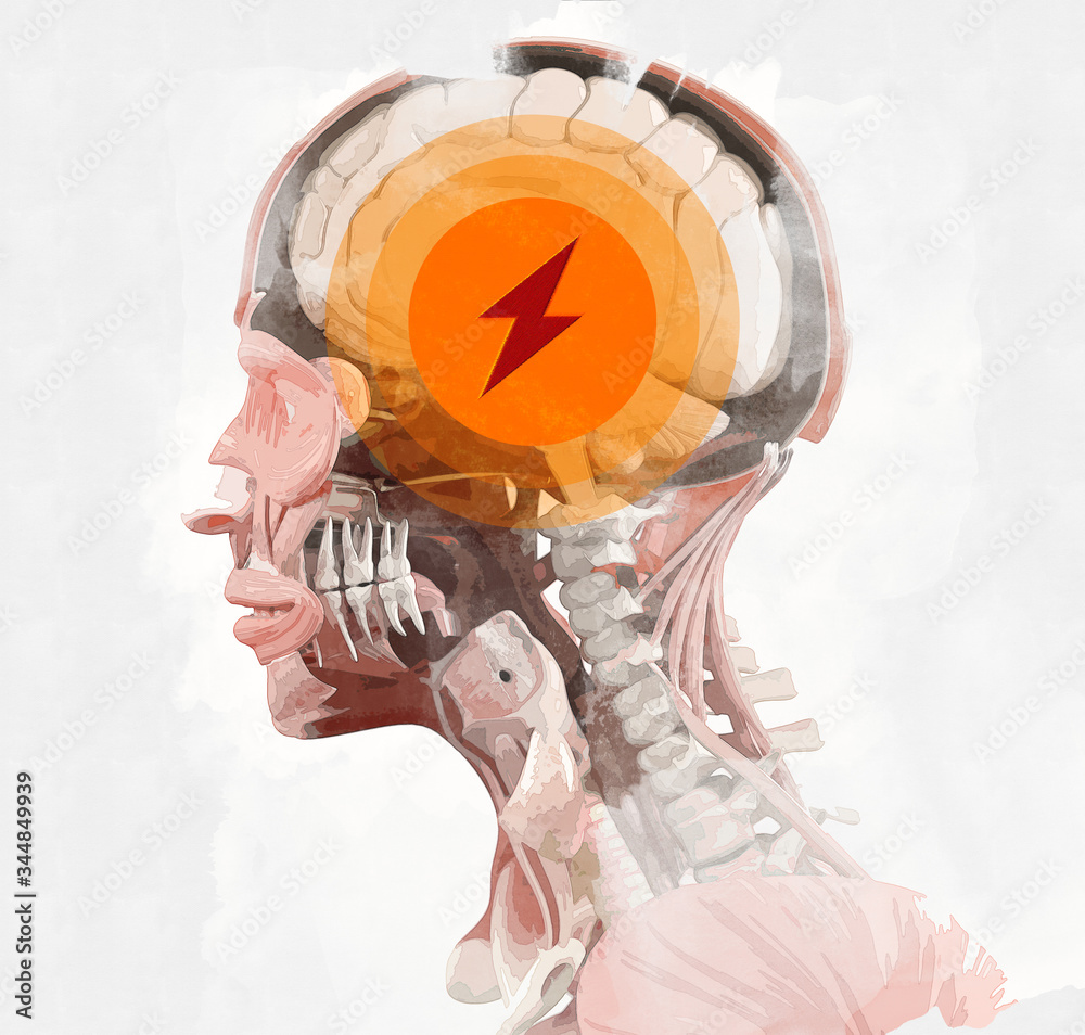 Stress, a graphic of a human head with a thunderbolt, showing stress ...