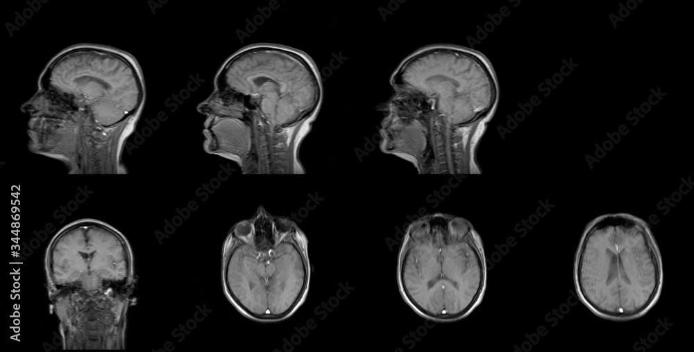 Fotografia do Stock: set of serial MRI scans of sixty years old ...