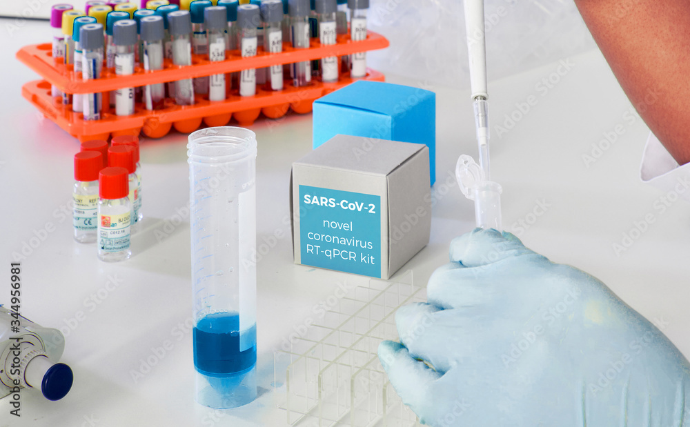 Laboratory interior, test lab, blood samples from patients with viral ...