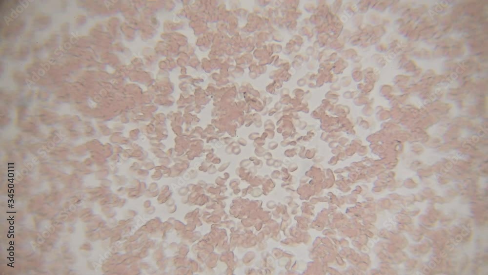 Fresh blood seen on a 400x microscope view. Blood smear under ...