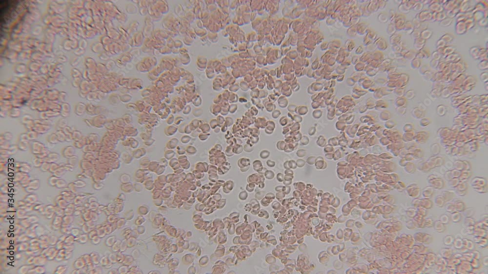 Fresh blood seen on a 400x microscope view. Blood smear under ...