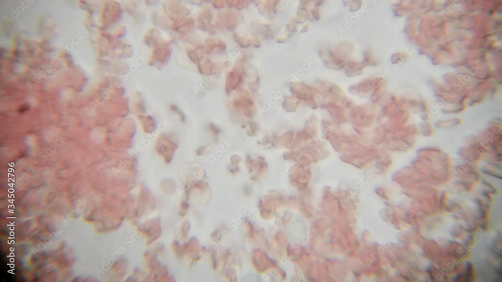 Fresh blood seen on a 1000x microscope view. Blood smear under ...