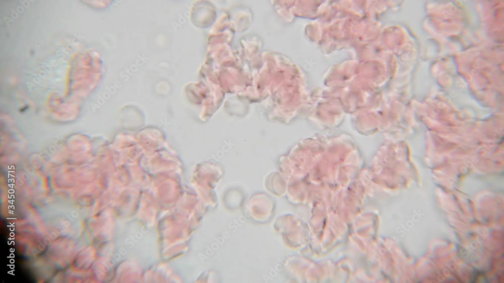 Fresh blood seen on a 1000x microscope view. Blood smear under ...