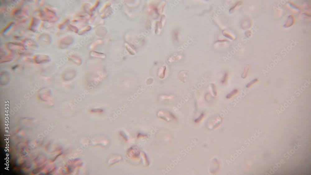 Fresh blood seen on a 1000x microscope view. Blood smear under ...