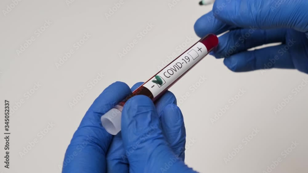 Negative result of COVID-19 test. Medical lab worker holding testing ...