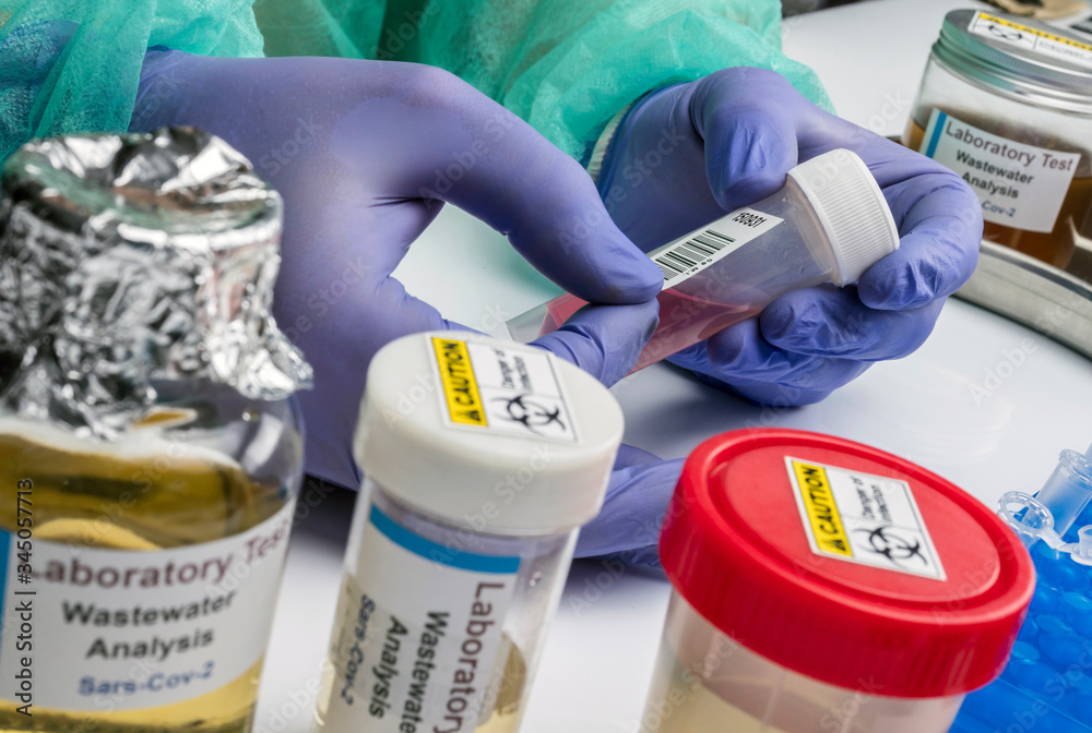Scientific analysis of wastewater sample in laboratory, investigation ...