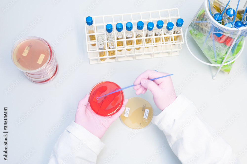 samples in a laboratory are spread on agar plates Stock Photo | Adobe Stock