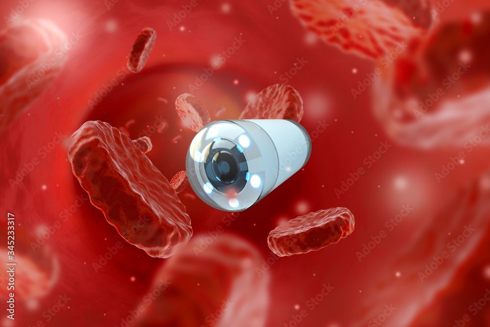 The camera is floating in miniature size along the vein with blood. The ...