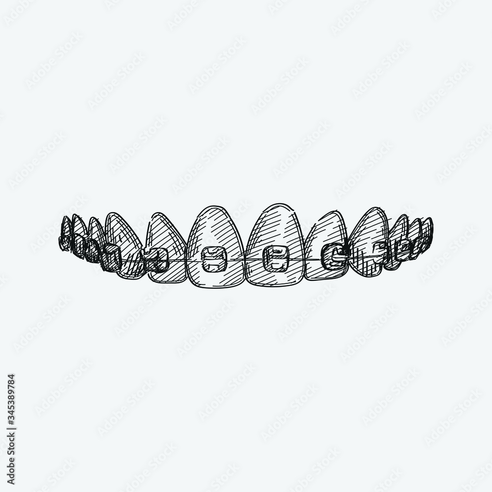 Hand-drawn sketch of teeth and braces on a white background. Dental ...