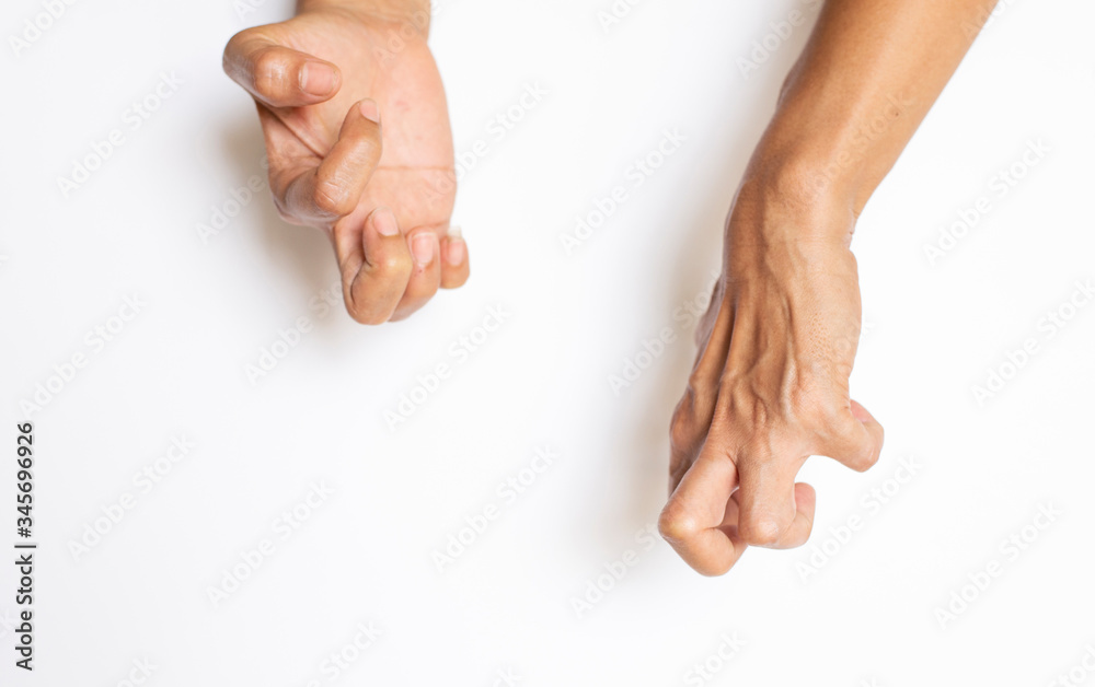 Symptoms of spasms of the synovial and hand and finger muscles Stock ...