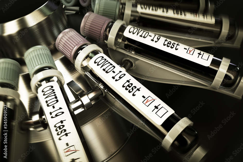 Vials of blood in a centrifuge. Negative COVID-19 test and laboratory ...