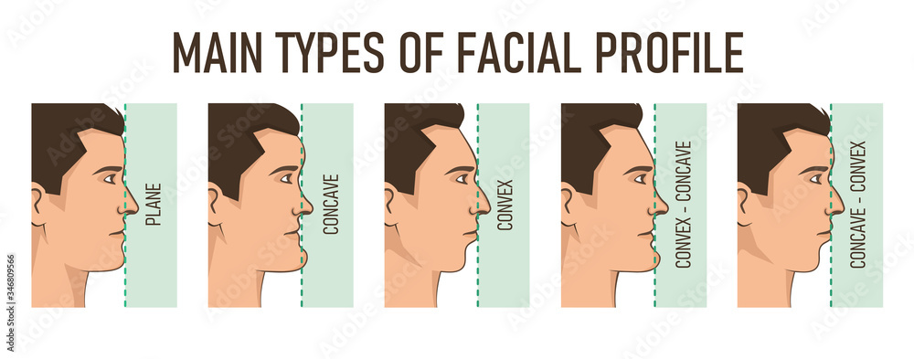 Main types of facial profile - convex, concave, plane. Stock Vector ...