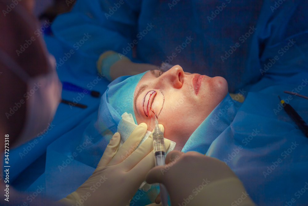 Surgeon inserts an injection into the upper eyelid of the patient ...