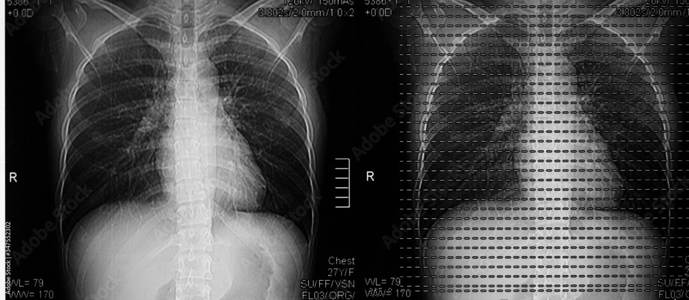 Whole abdomen MRI scan (Magnetic Resonance Image) High resolution.Human ...