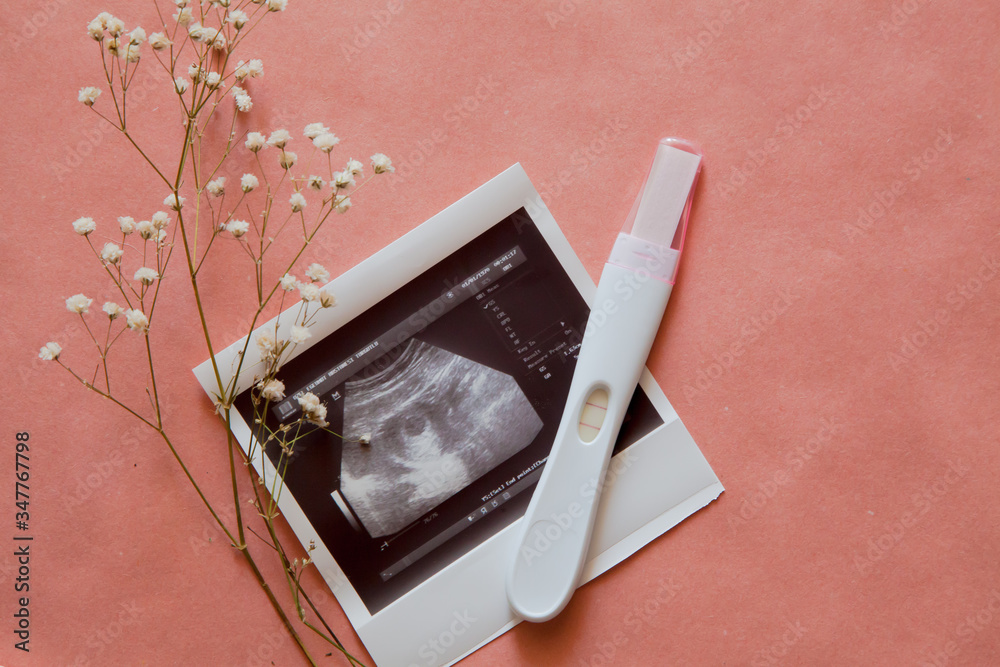 Ultrasound scan of an unborn baby of fifth week with a pregnancy test ...