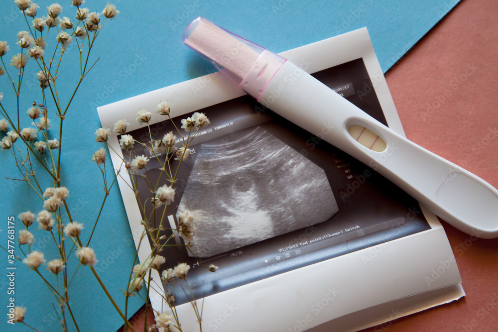 Ultrasound scan of an unborn baby of fifth week with a pregnancy test ...