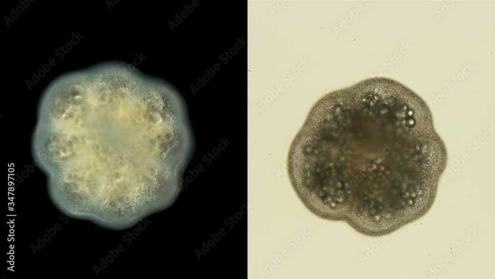 coral larva under a microscope, Order: Actiniaria, Phylum: Cnidaria ...