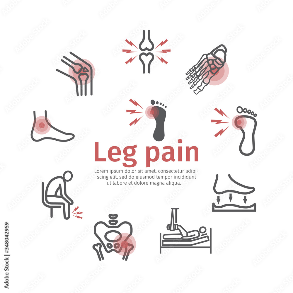 Leg pain. line icons. Infographics. Foot problems. Vector signs for web ...