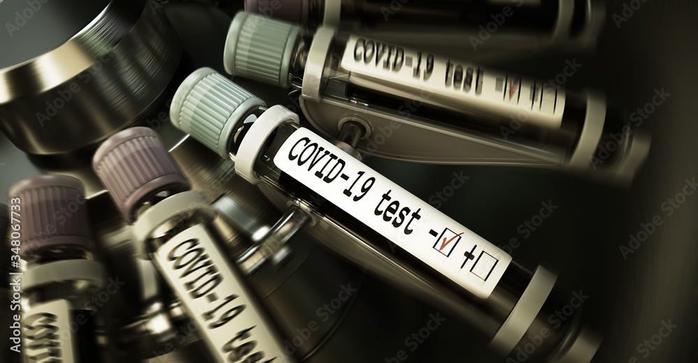 Vials of blood in a centrifuge. Negative COVID-19 test and laboratory ...