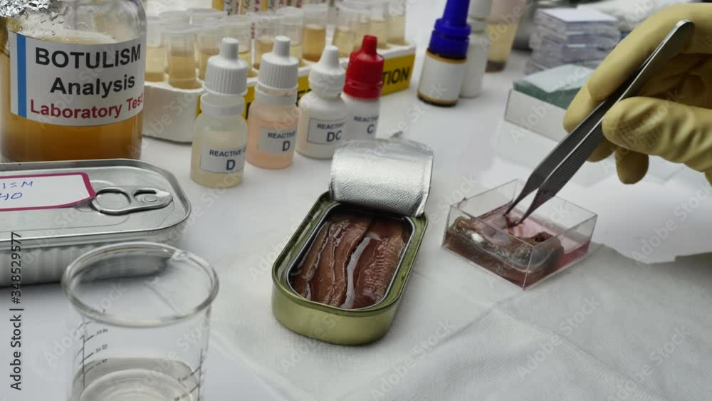 Experienced laboratory scientist analyzing a fecal sample, botulism ...