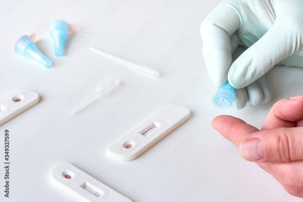Rapid COVID-19 test for detection of specific antibodies IgM and IgG to ...