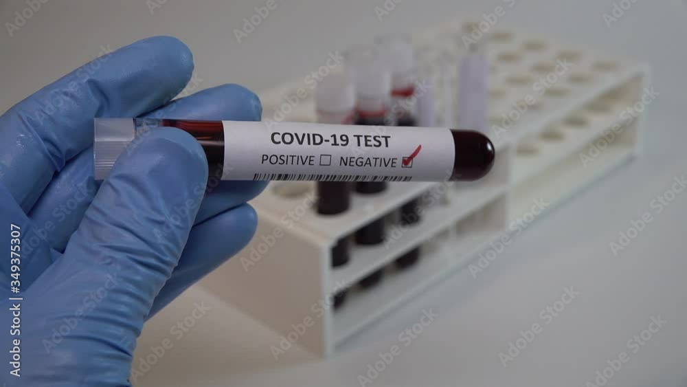 Doctor wearing medical gloves reveals negative test results for Covid ...
