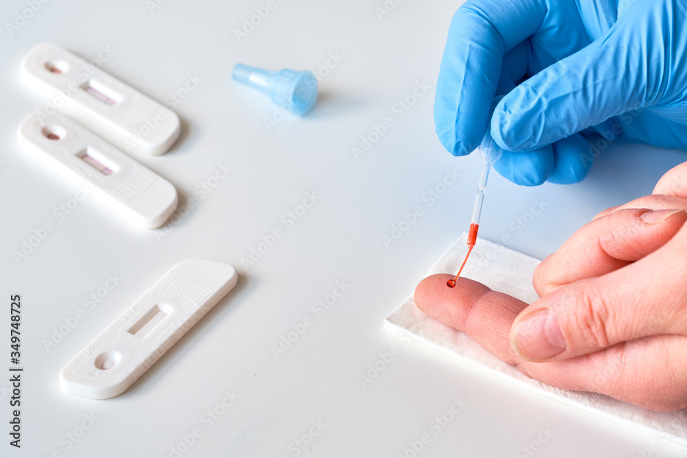 Rapid COVID-19 test for detection of specific antibodies IgM and IgG to ...