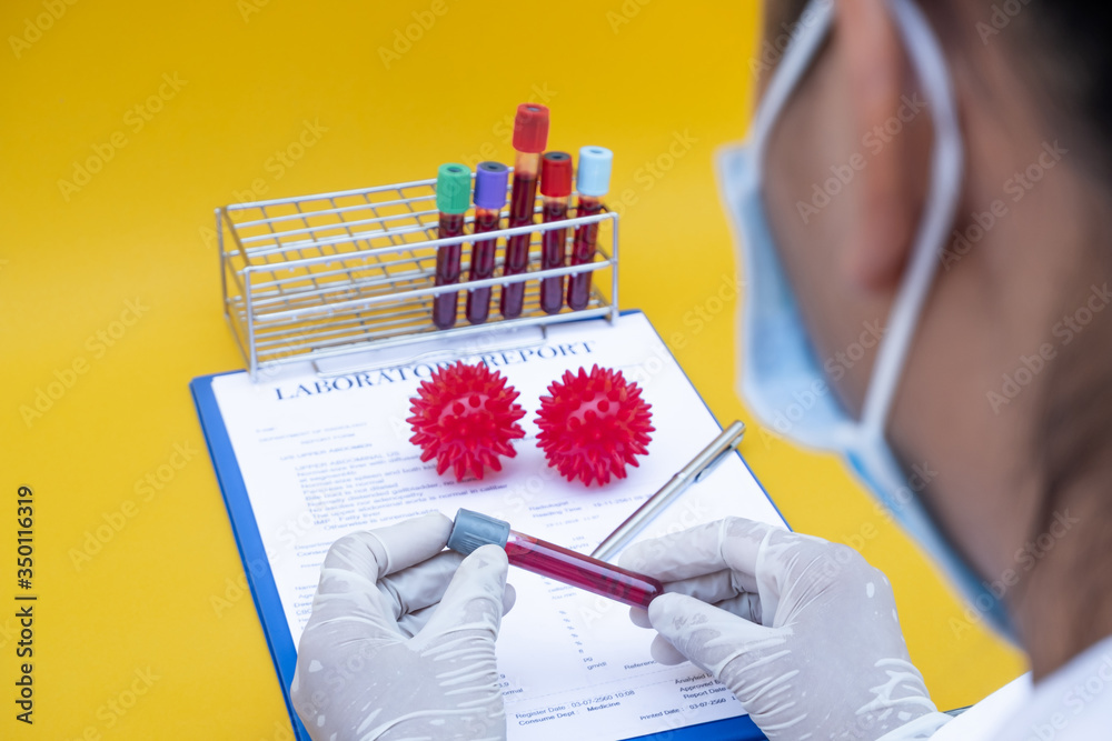 Professional doctors perform COVID-19 tests from samples of blood tests ...